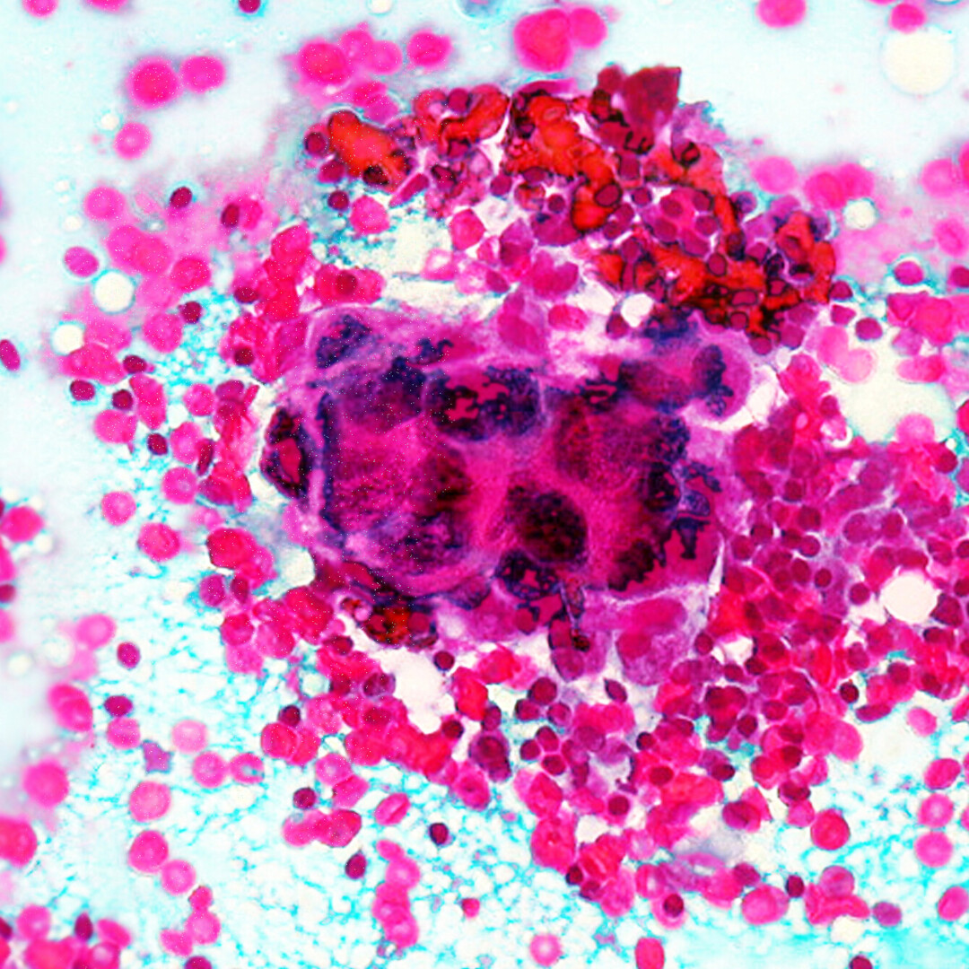 Berufsbild der Pathologen und die Weiterbildung